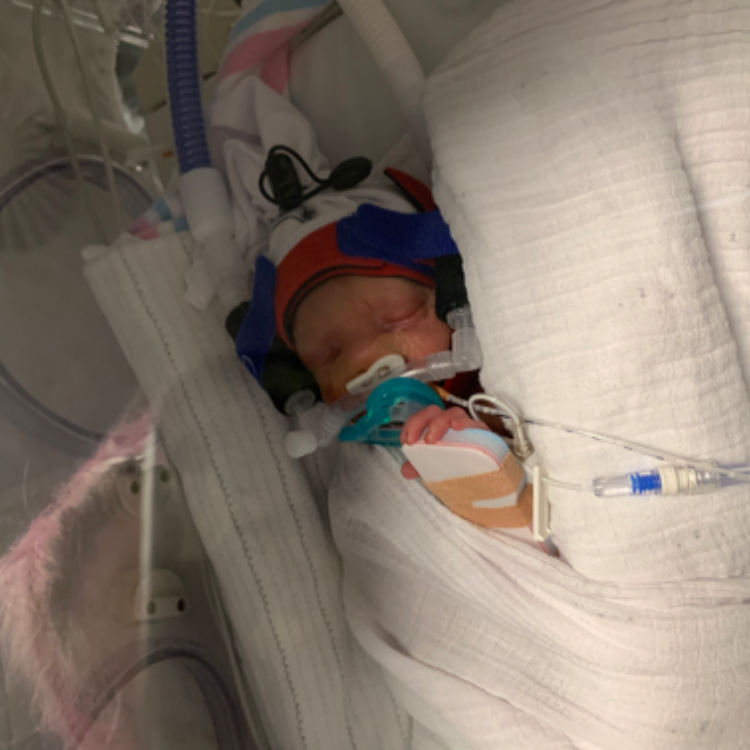 Chester - Miracle Babies